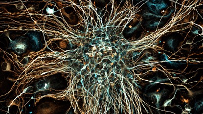 Nouvelles de la recherche – Juin 2023 | CHU de Québec-Université Laval